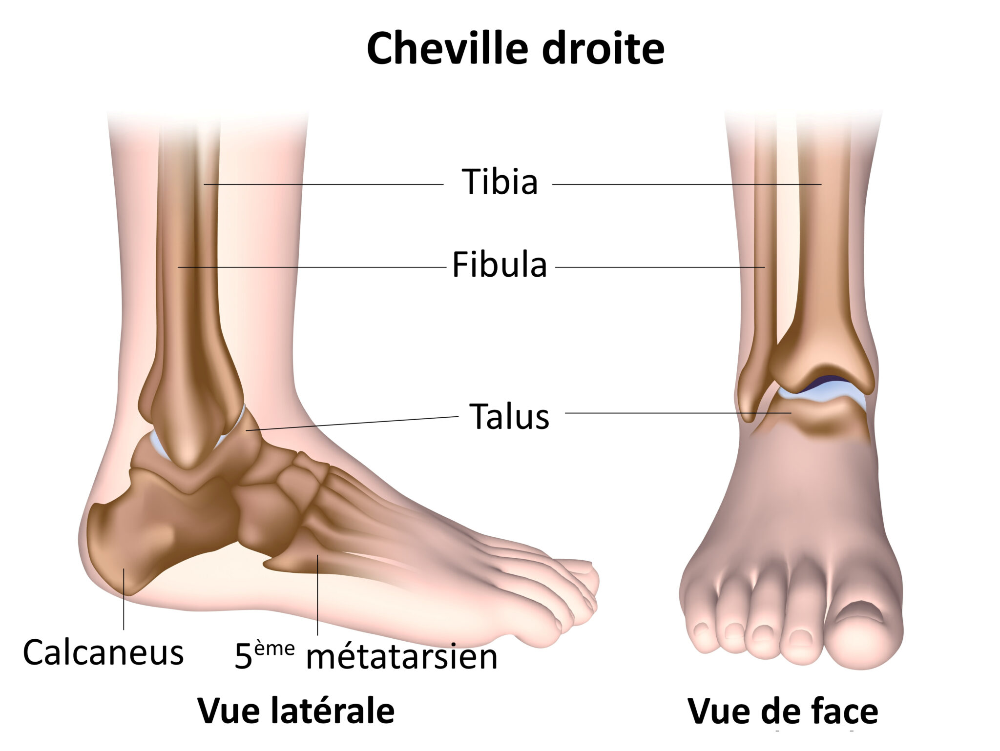 Le louedec | SYNDROME DU SINUS DU TARSE